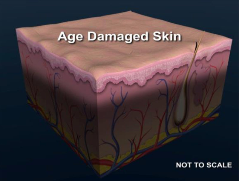 Phoenix CO2 Laser System | Novique Medical Aesthetics