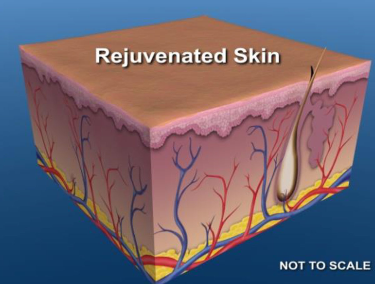 Phoenix CO2 Laser System | Novique Medical Aesthetics